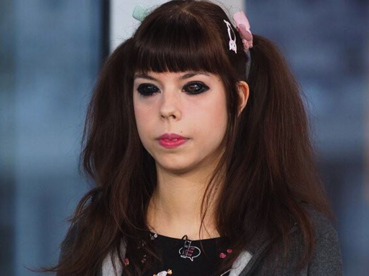 Modelo de 25 años se tatuó los ojos y quedó ciega